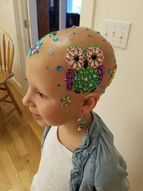 Creative young girl with alopecia wins school's Crazy Hair Day | whas11.com