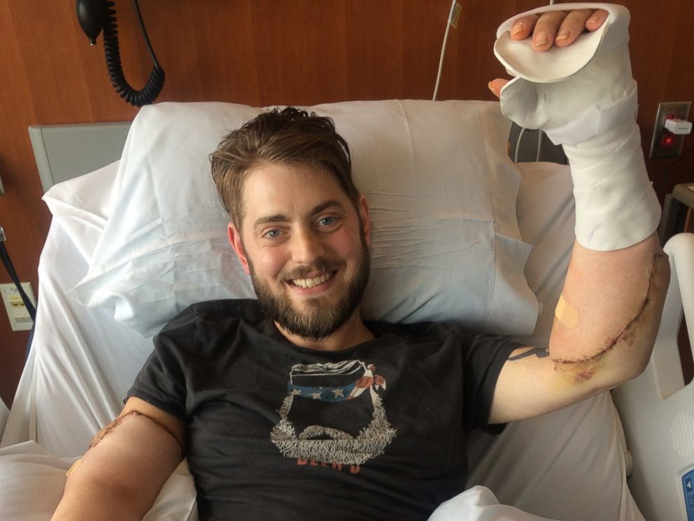 Retired Marine who underwent double arm transplant wiggles fingers ...